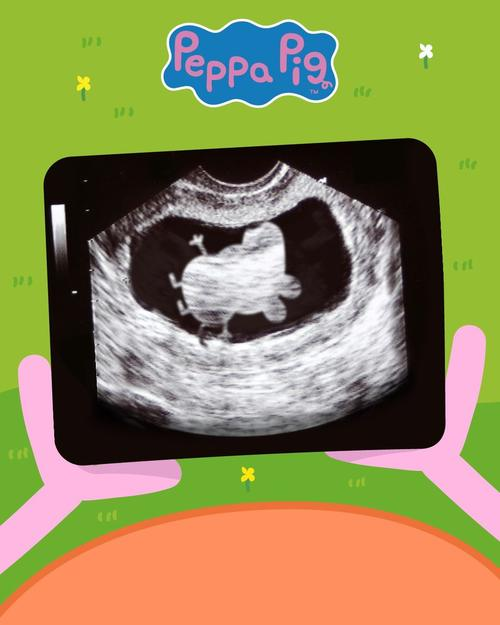 Publican la primera ecografía del nuevo hermanito de Peppa Pig ...